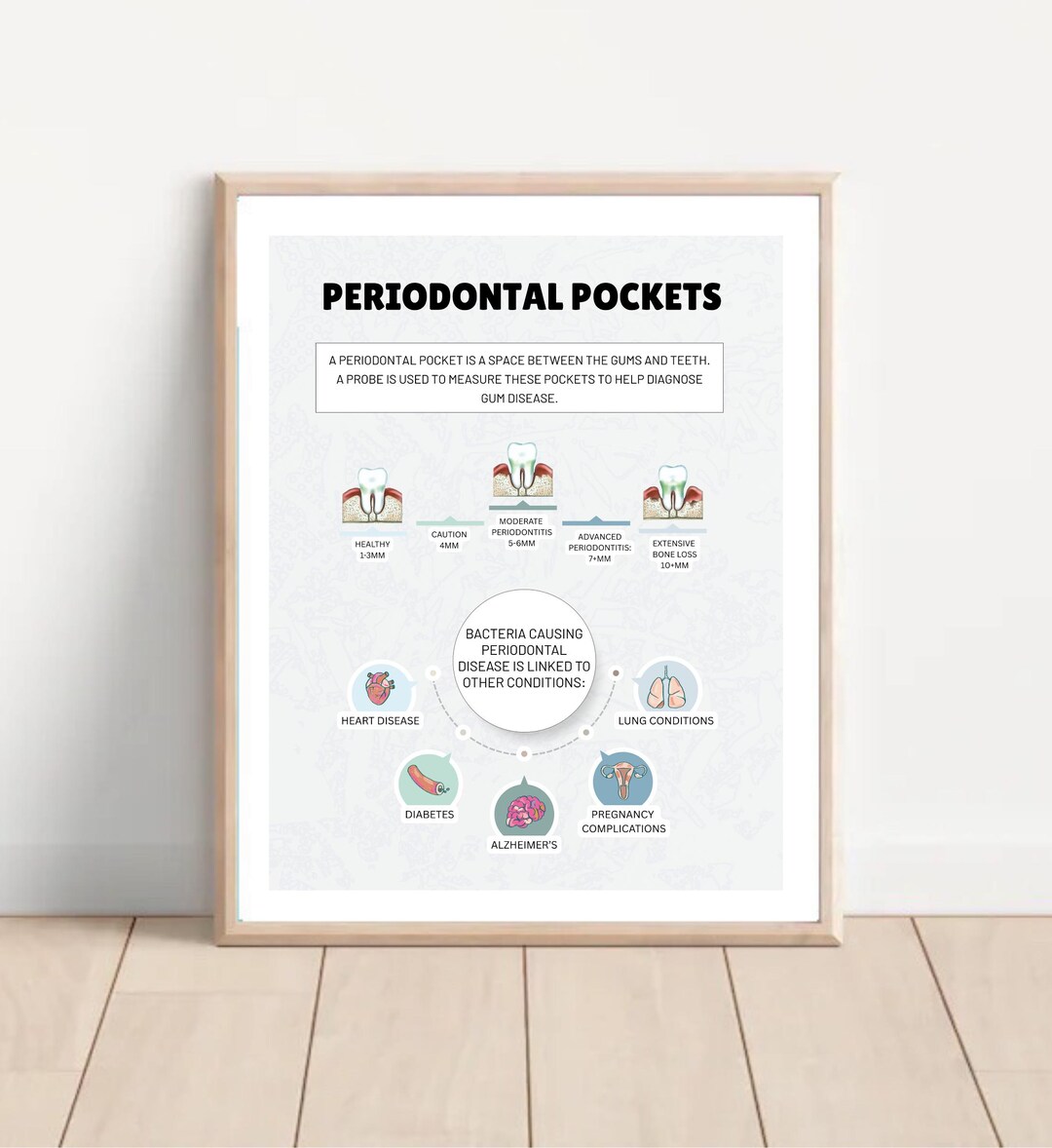 Periodontal Pockets for Patient Education Poster, Periodontal Disease ...