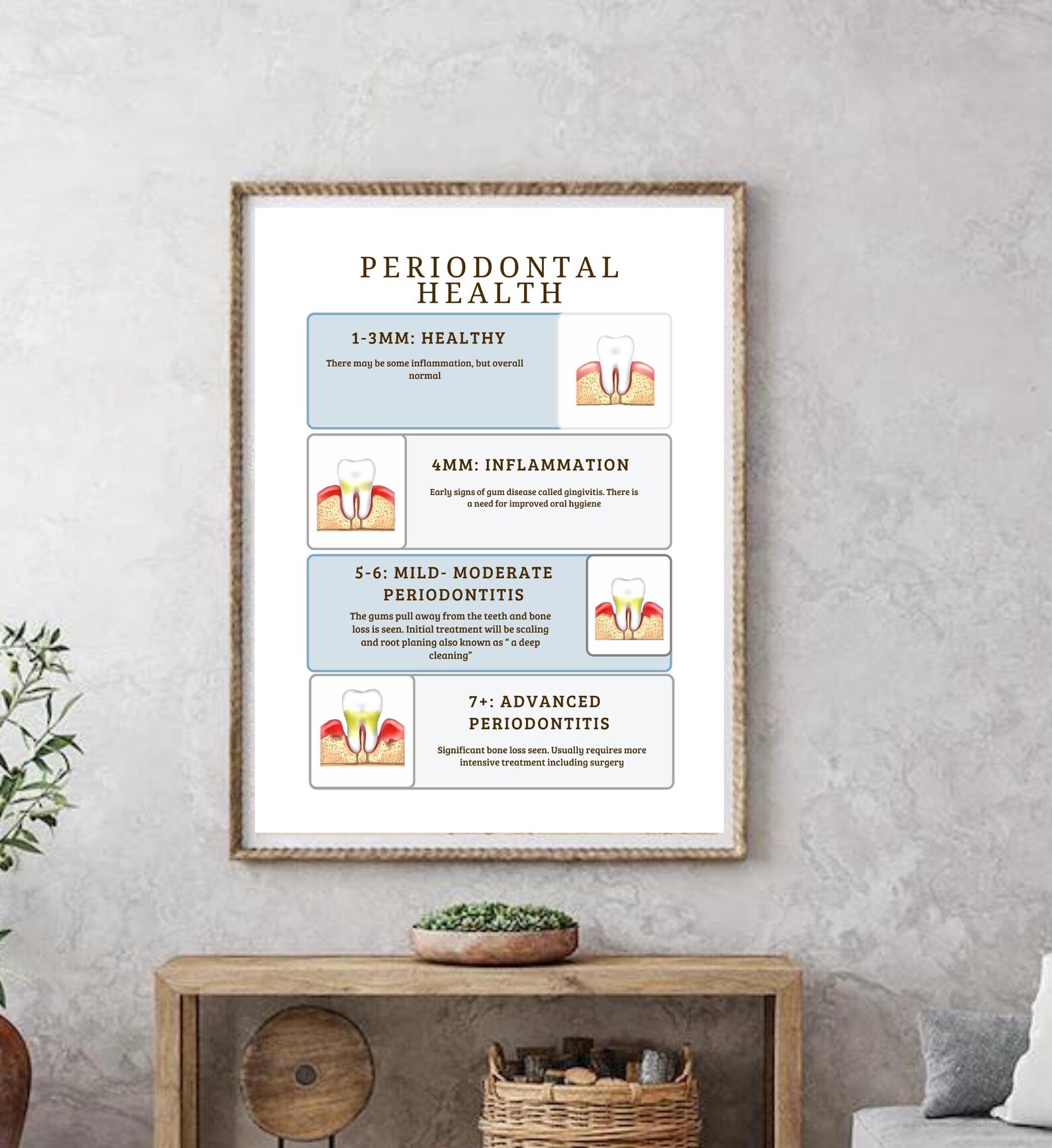 Periodontal Disease Wall Art, Gum Disease Patient Education Poster ...
