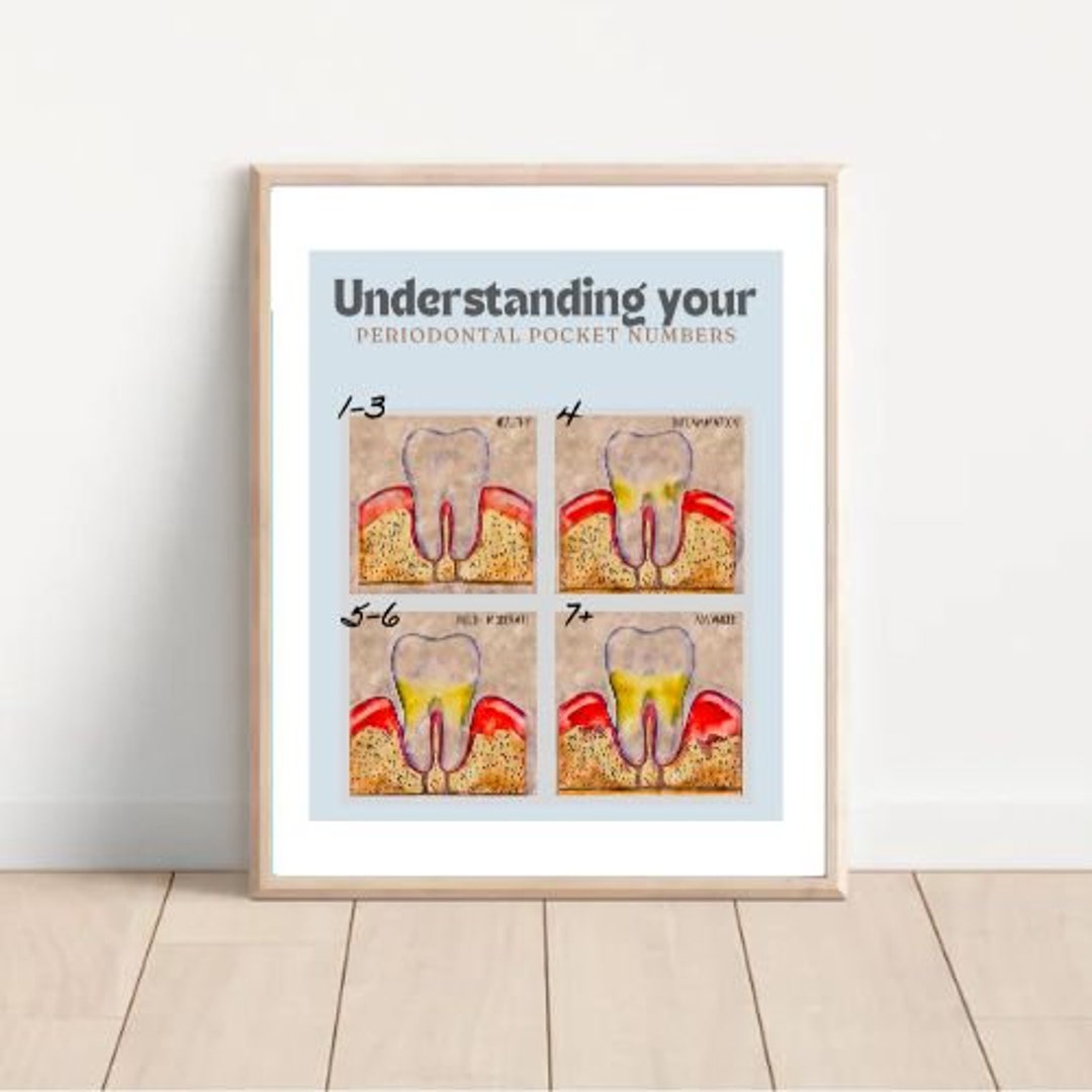 Gum Disease Poster, Periodontal Disorder Education, Periodontist Decor ...