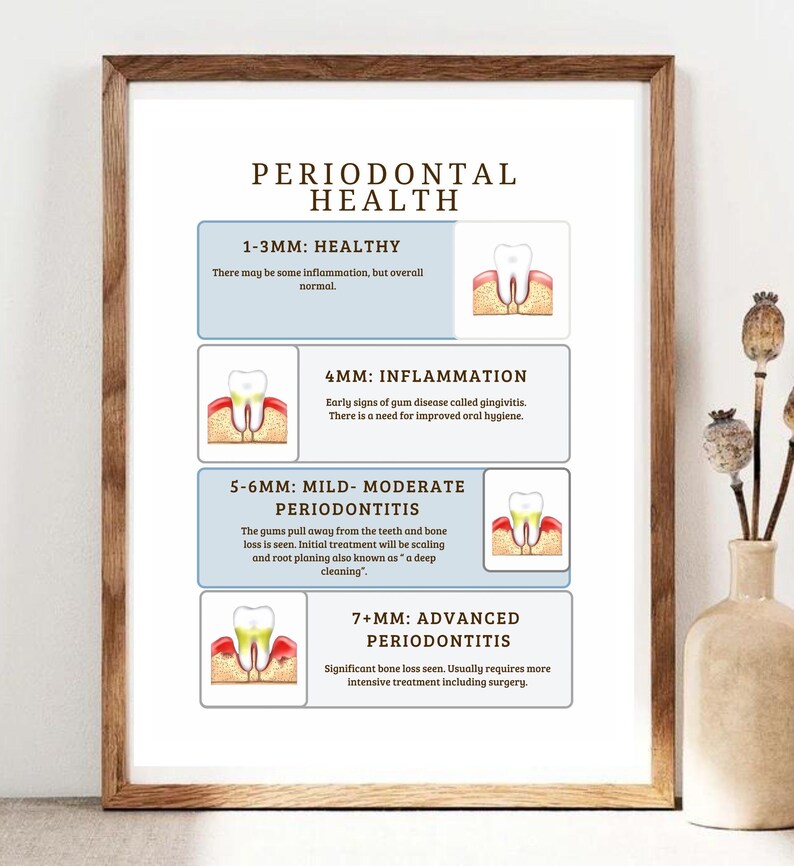 Periodontal Health Poster: Gum Disease Patient Education, Dental Office ...
