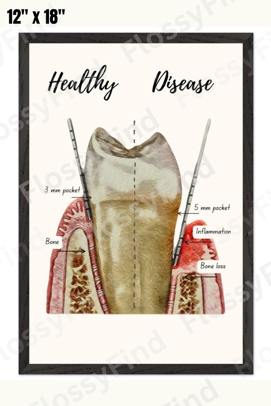 Framed Periodontal Anatomy Poster: Dental Office Decor - Etsy