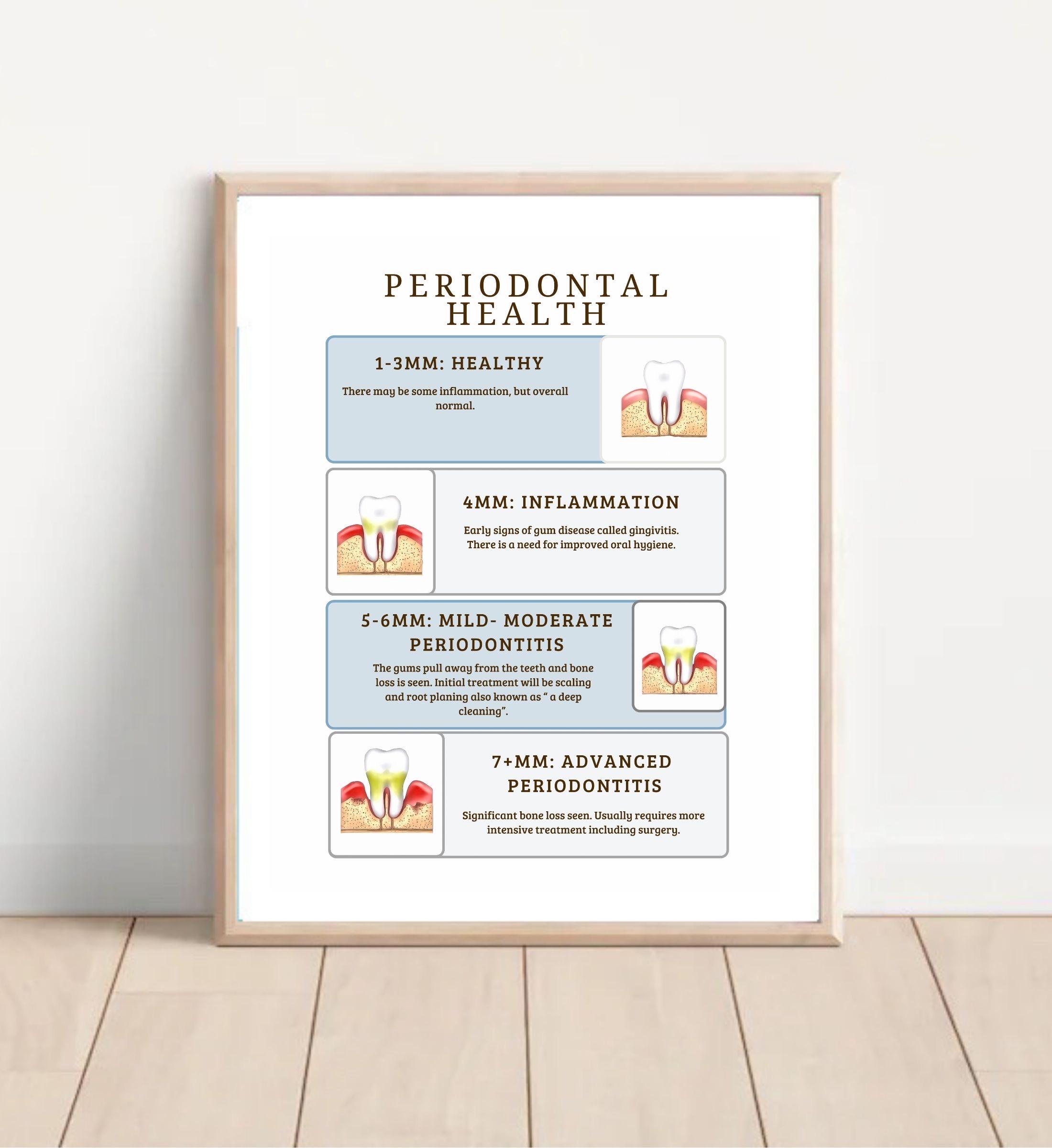 Periodontal Health Poster: Gum Disease Patient Education, Dental Office ...