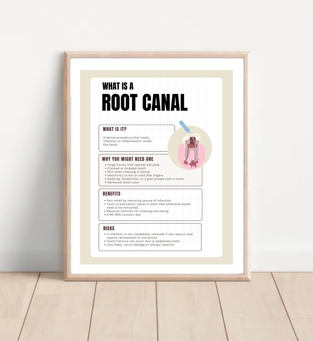 What is a Root Canal Poster, Dental Office Education Wall Decor ...