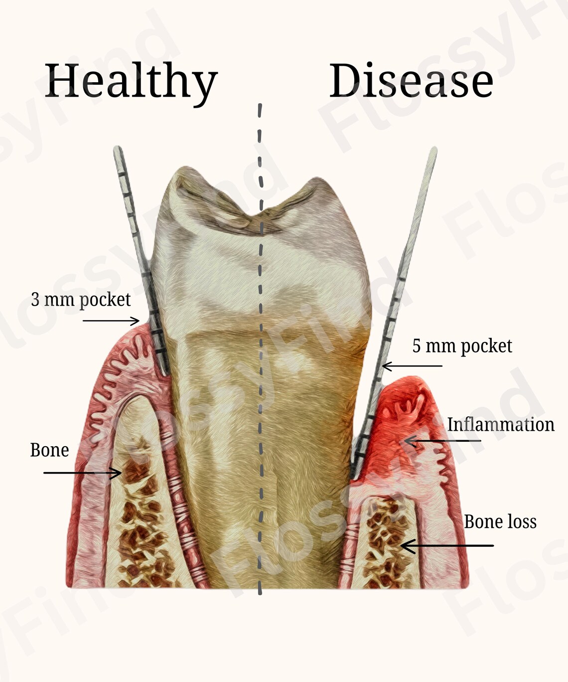 Digital Download Tooth Chart, Downloadable Periodontal Print, PNG Tooth ...