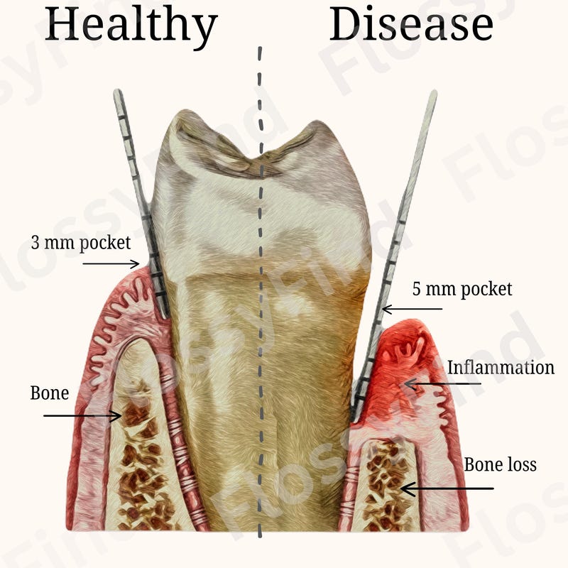 Tooth Periodontal Poster - Etsy