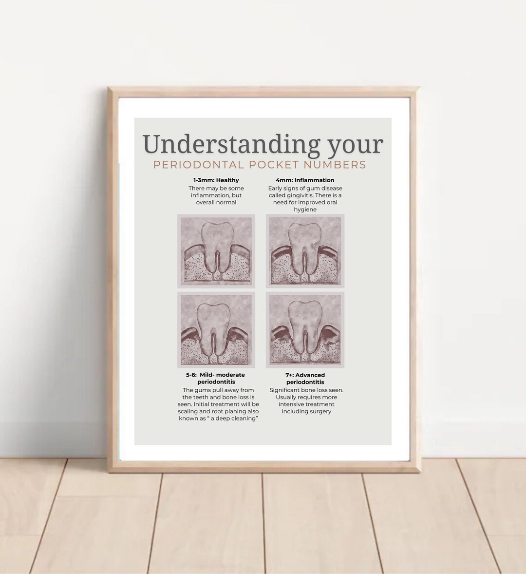 Periodontal Disease Poster: Gum Disease Patient Education, Dental ...