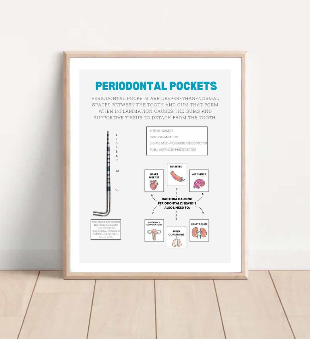 Periodontal Probing Poster, Dental Hygiene Education, Dental Office ...
