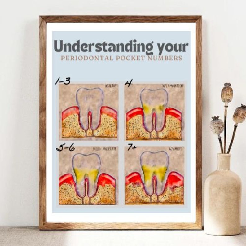 Gum Disease Poster, Periodontal Disorder Education, Periodontist Decor ...