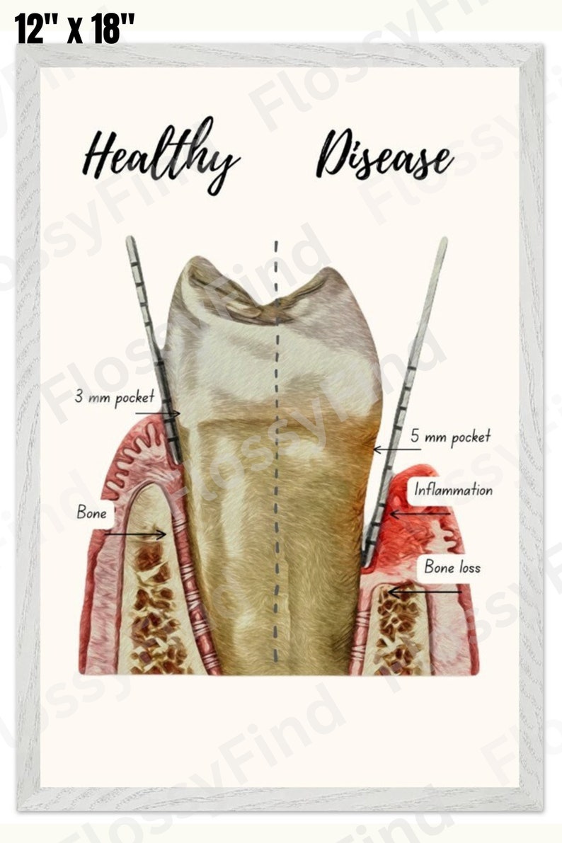 Framed Periodontal Anatomy Poster: Dental Office Decor - Etsy