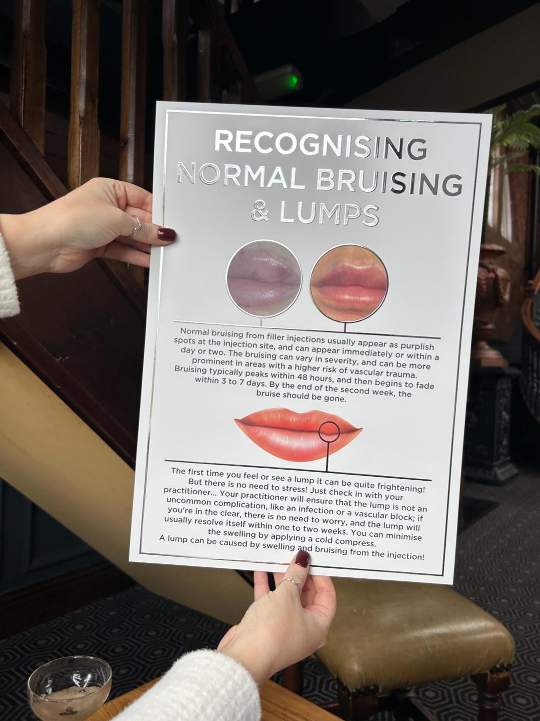 A3 Raised Foiled Normal Bruising & Lumps Poster - Etsy