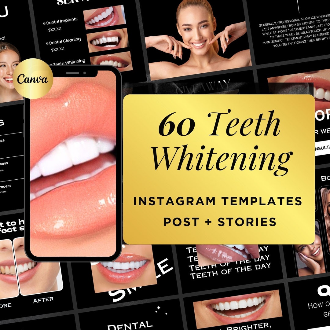 60 Teeth Whitening Instagram Templates Teeth Whitening Posts Teeth ...