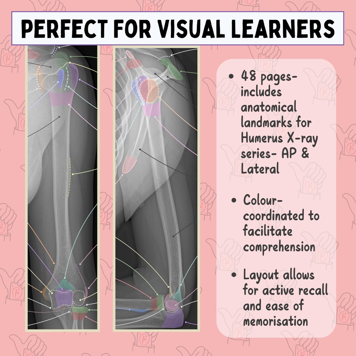 Humerus X-ray Anatomy Study Guide: AP & Lateral Views (PDF) - Etsy
