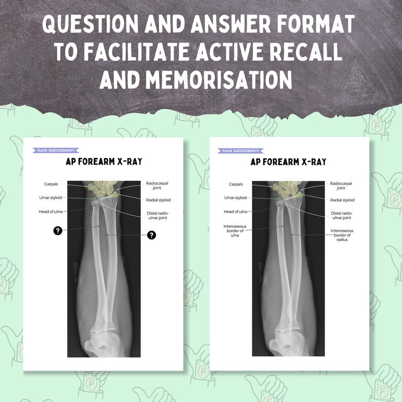 2025 Forearm X-ray Anatomy, AP and Lateral Study Bundle for Rad Techs ...