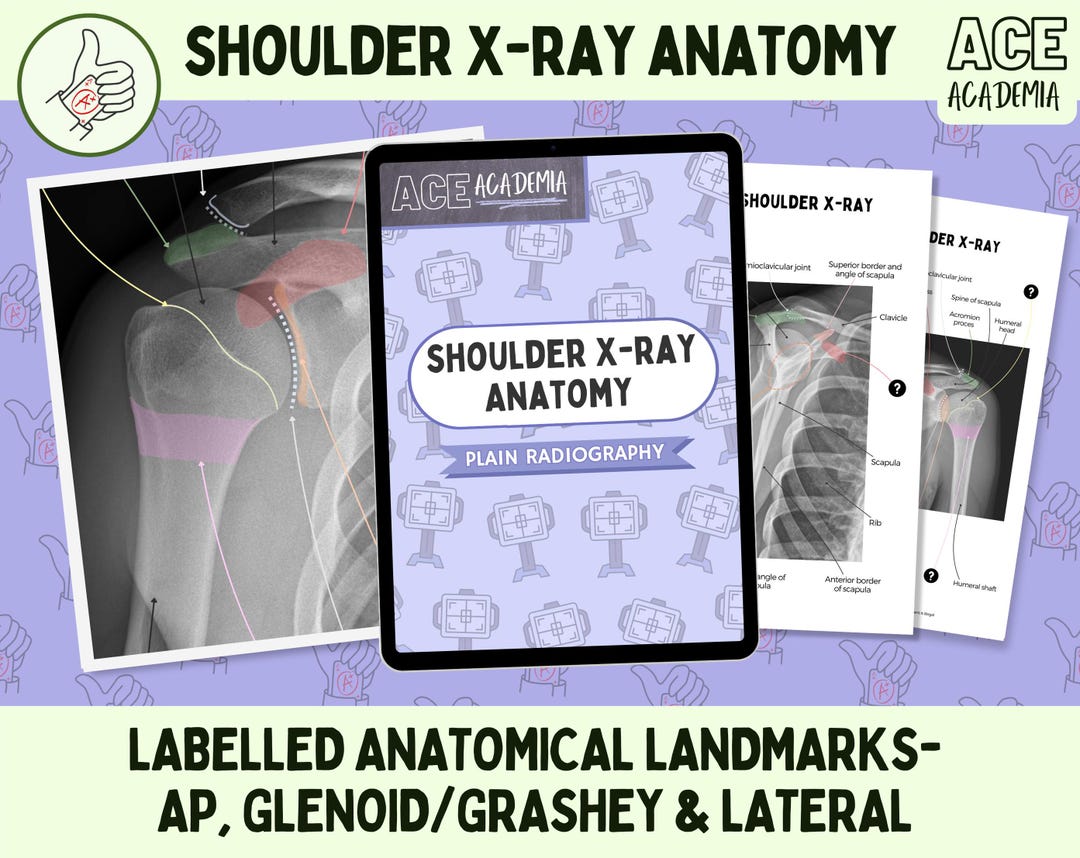 Shoulder X-ray Anatomy, AP, Glenoid and Lateral Views for Rad Techs ...