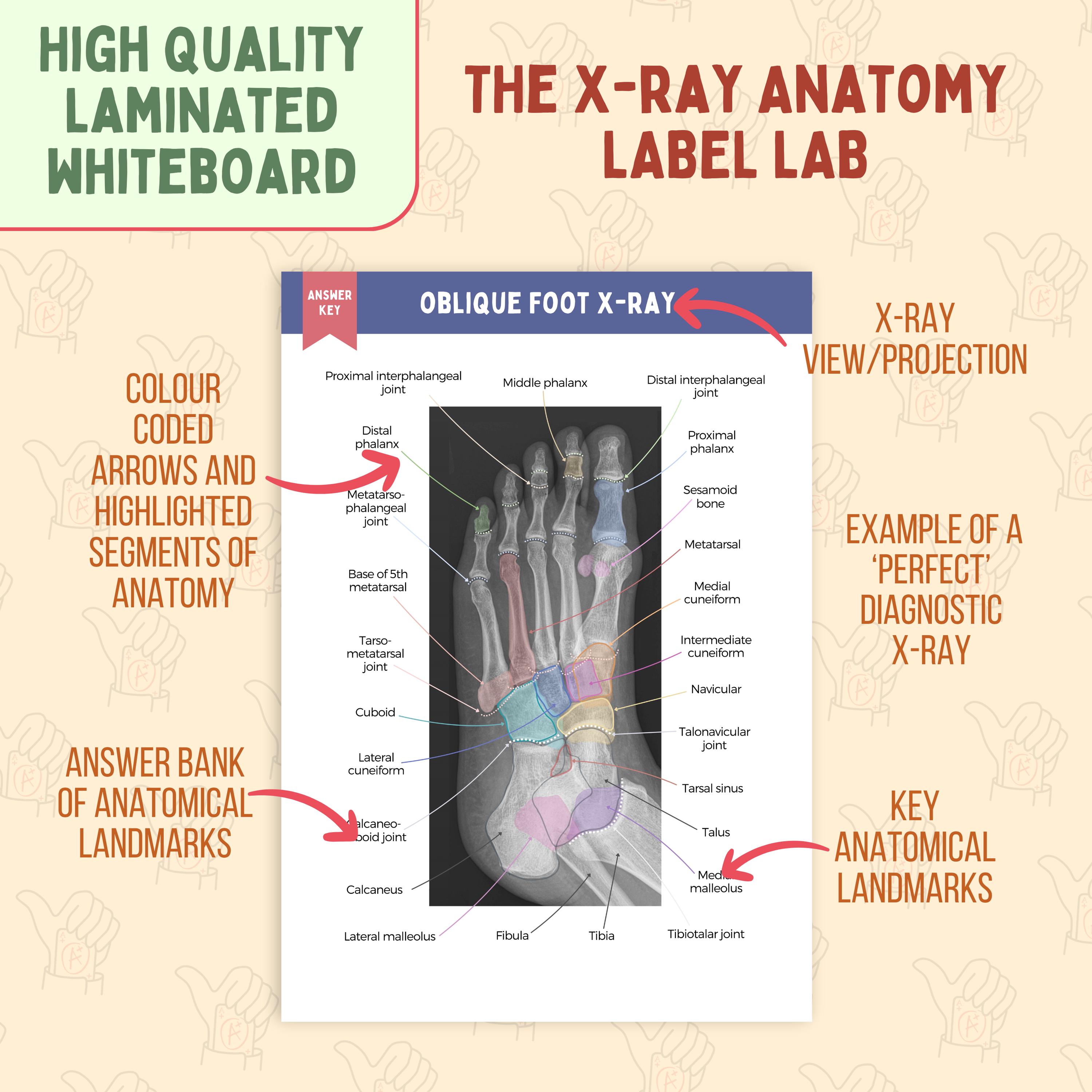 The X-ray Anatomy Label Lab Dry Erase Workbook, 100+ Pages of X-ray ...