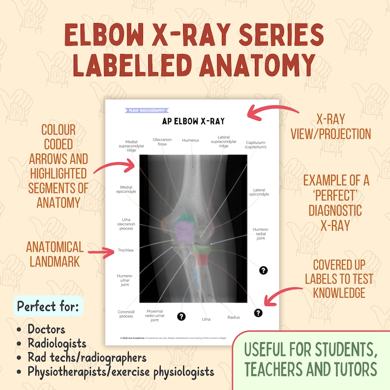 Elbow X-ray Anatomy, AP Oblique and Lateral Views for Rad Techs ...