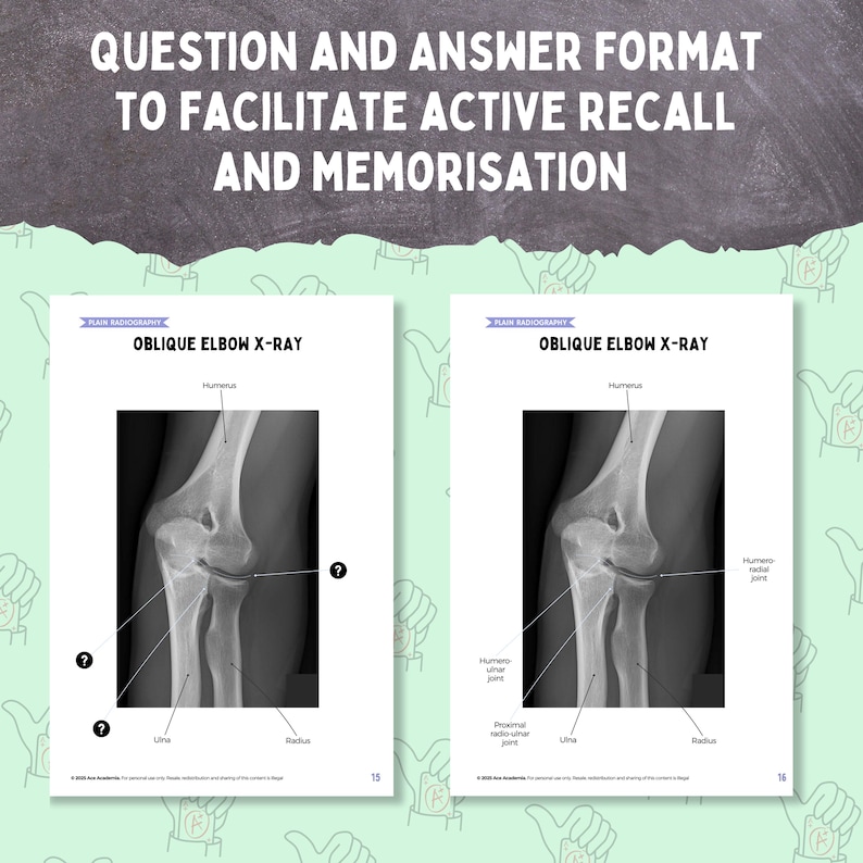 Elbow X-ray Anatomy, AP Oblique and Lateral Views for Rad Techs ...