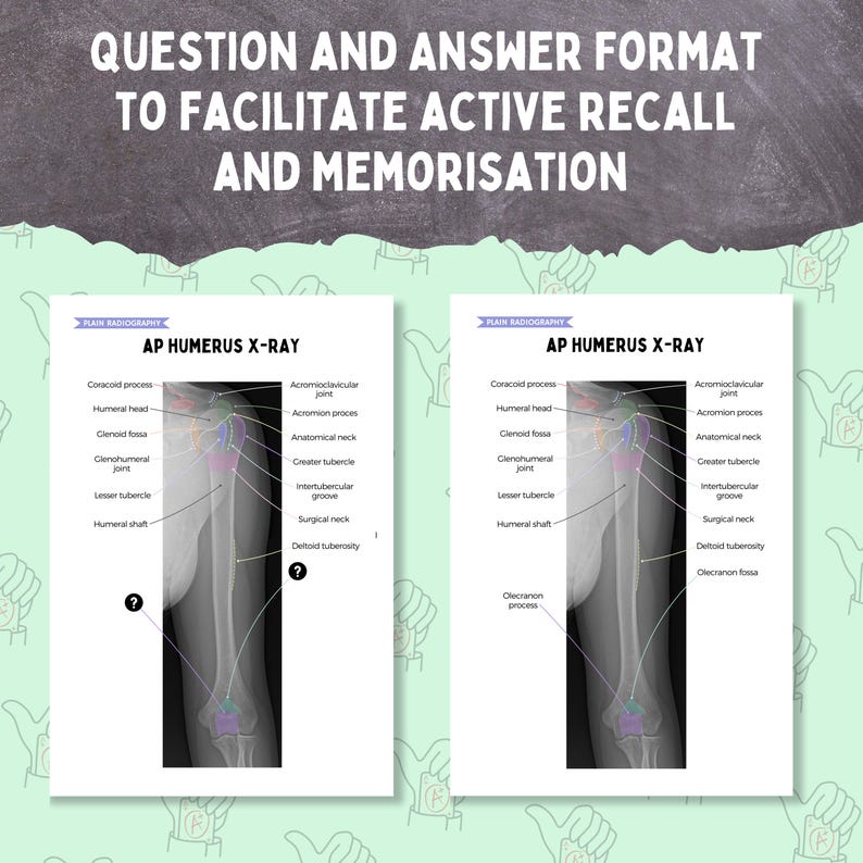 Humerus X-ray Anatomy Study Guide: AP & Lateral Views (PDF) - Etsy