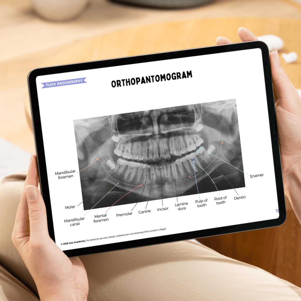 2026 OPG Dental X-ray Anatomy, Orthopantogram for Rad Techs ...