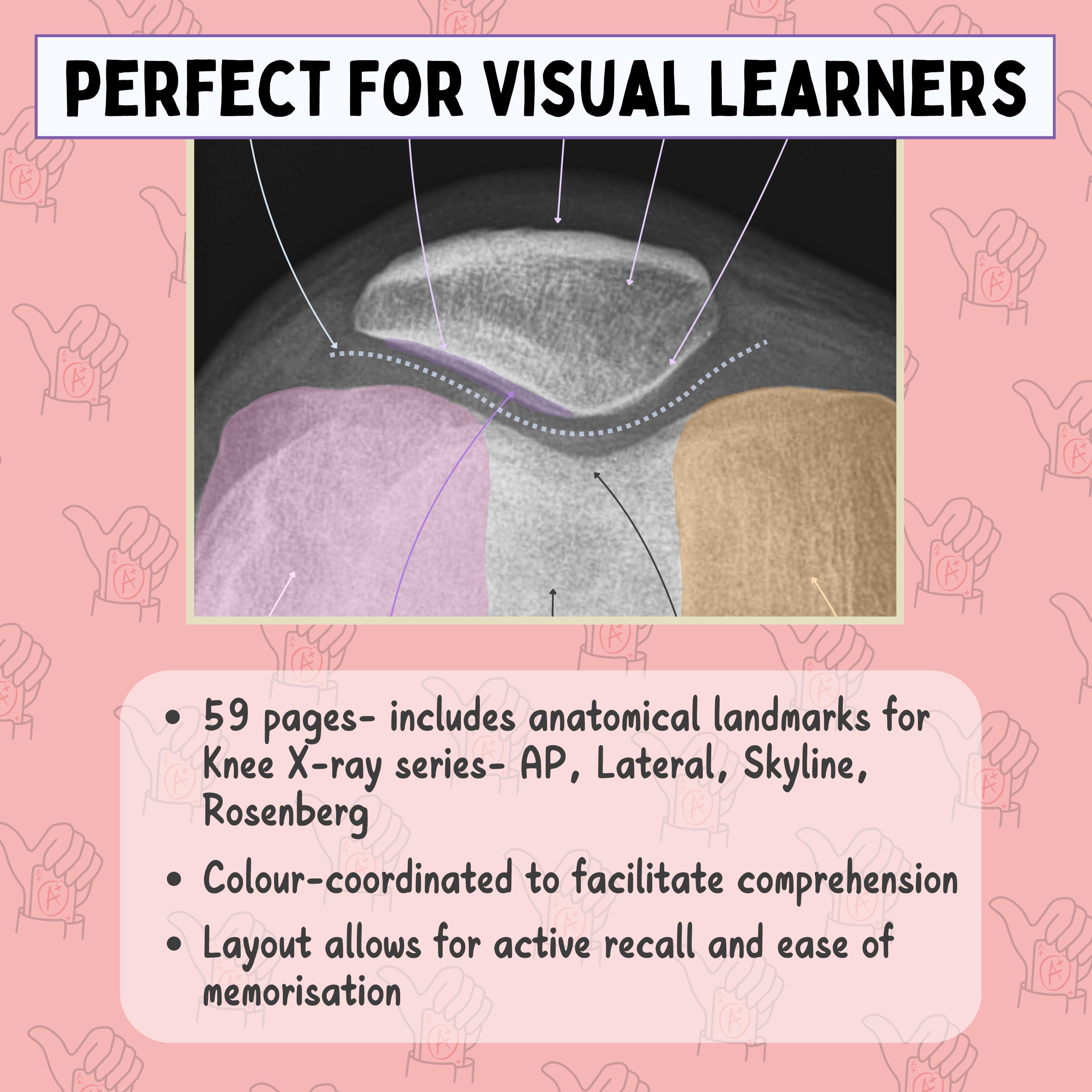 Knee X-ray Anatomy, AP Lateral Skyline and Rosenberg Views for Rad ...