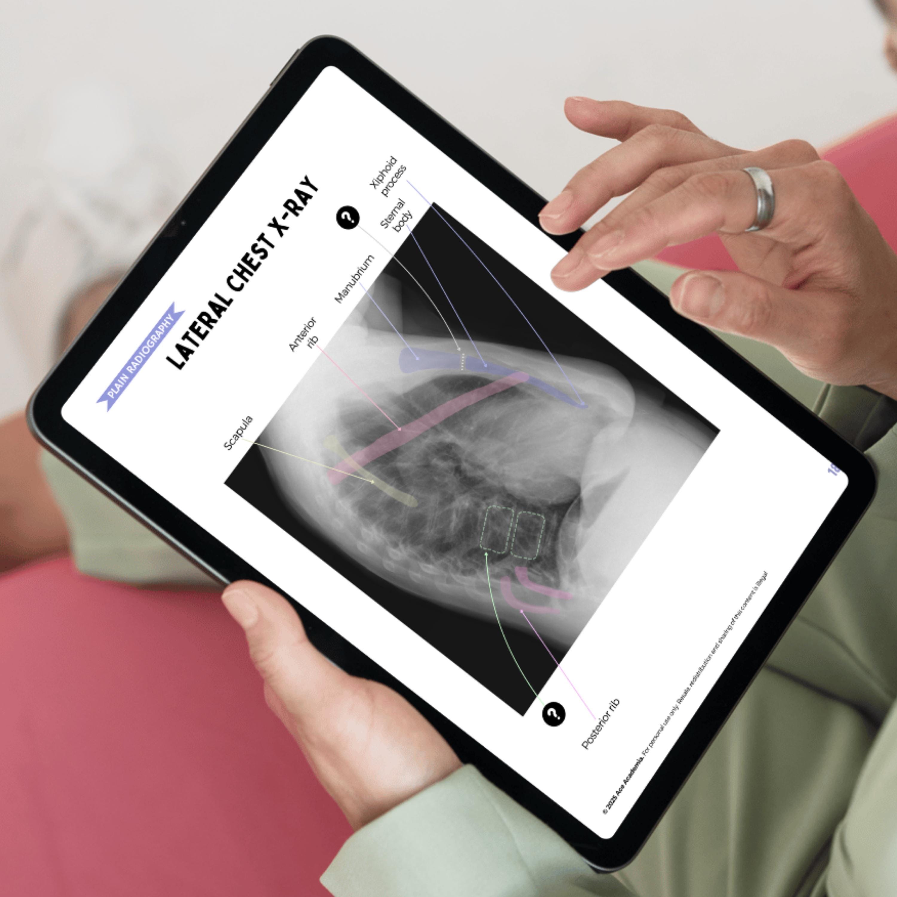 Chest X-ray Anatomy, PA and Lateral Views for Rad Techs, Radiographers ...