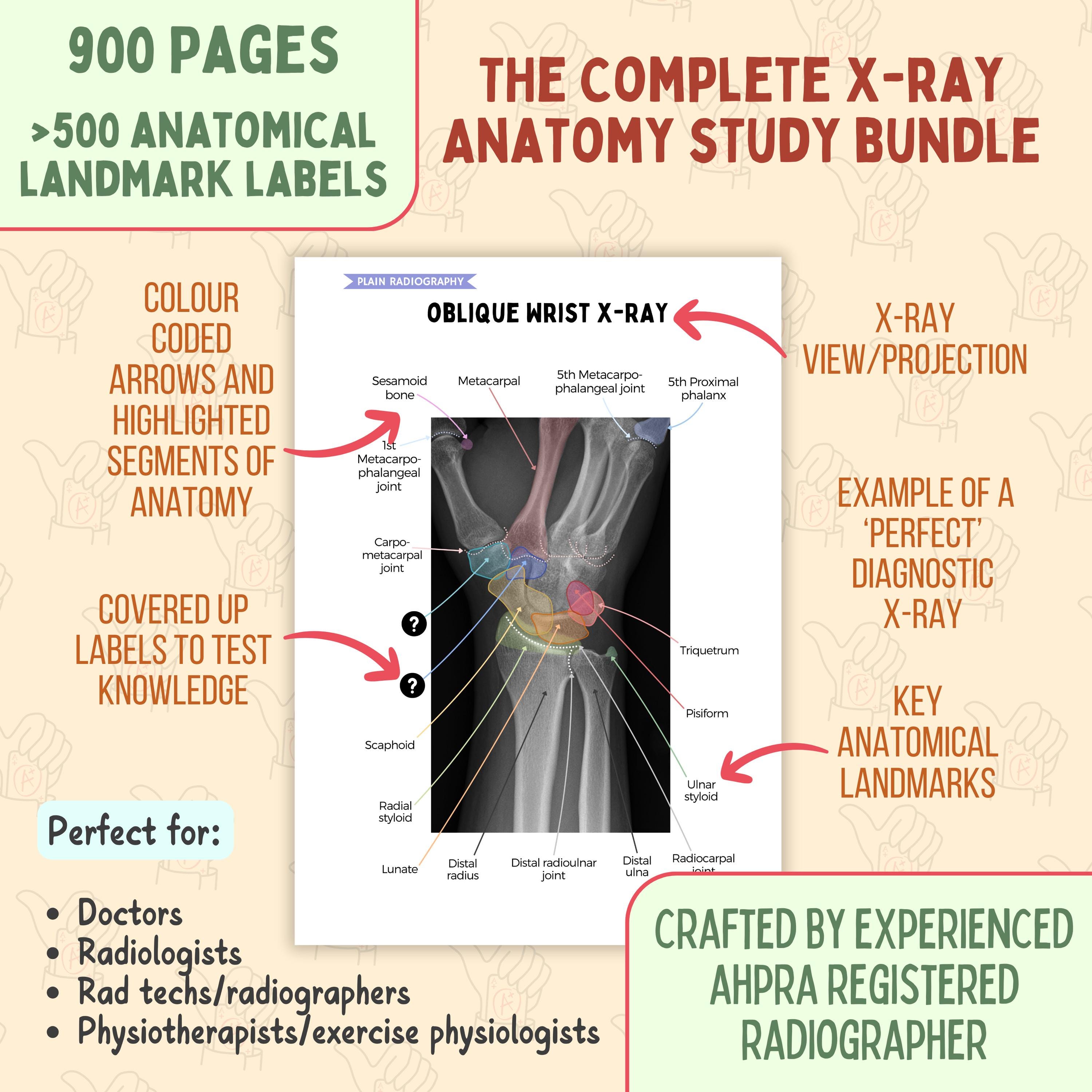 The Complete 2025 X-ray Anatomy Study Bundle, 900 Page Radiography ...