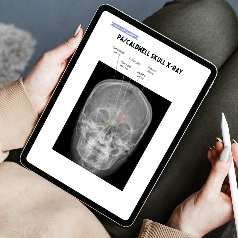 Skull X-ray Anatomy, Pa/caldwell, Om/waters & Lateral, 2025 Radiography ...