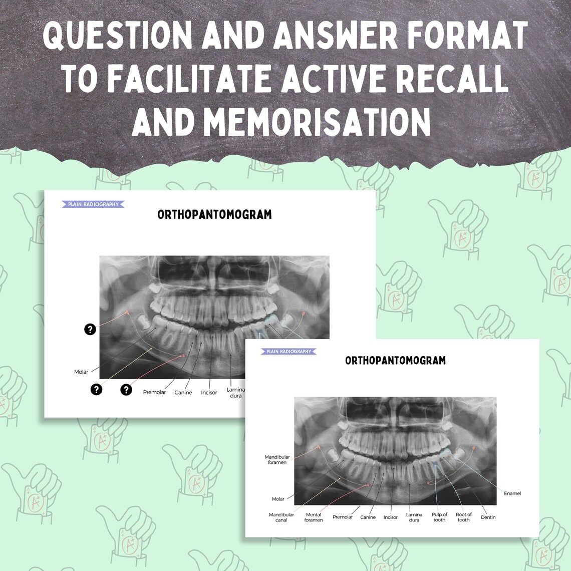 2026 OPG Dental X-ray Anatomy, Orthopantogram for Rad Techs ...