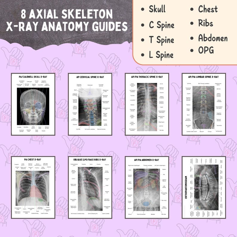 Axial Skeleton X-ray Anatomy Bundle: Radiography Study (PDF) - Etsy