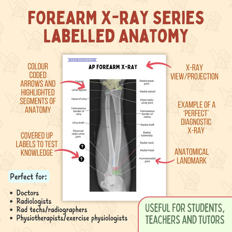 2025 Forearm X-ray Anatomy, AP and Lateral Study Bundle for Rad Techs ...