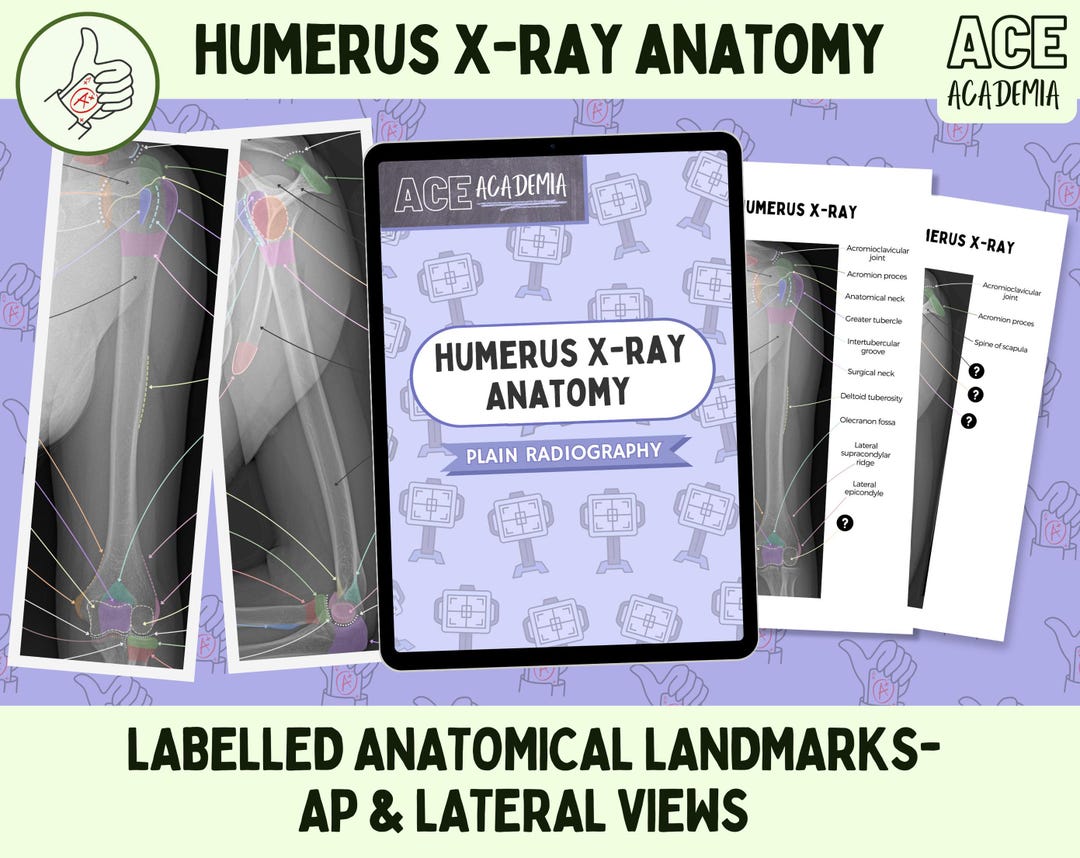 2025 Humerus X-ray Anatomy, AP and Lateral Study Bundle for Rad Techs ...