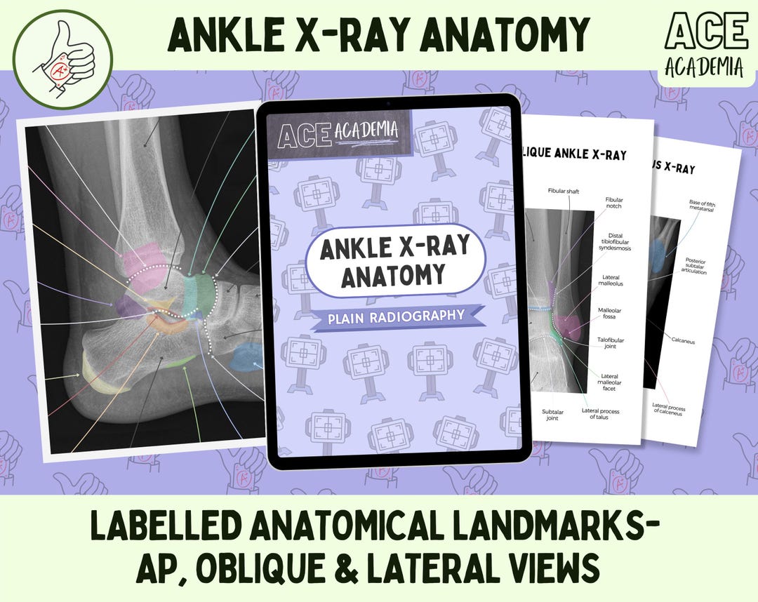 2025 Ankle X-ray Anatomy, AP Oblique & Lateral Radiography Study Bundle ...