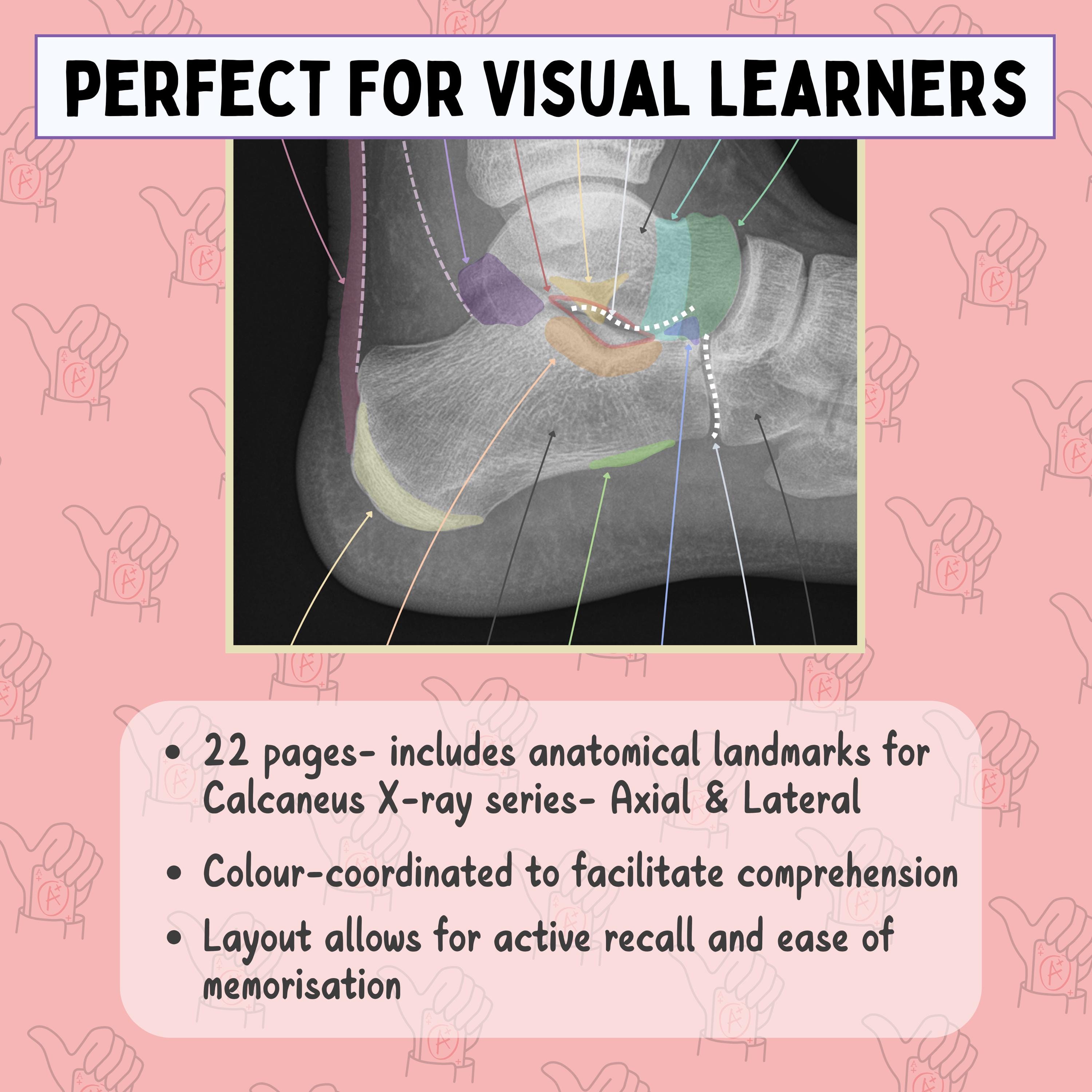 2026 Calcaneus X-ray Anatomy, Axial and Lateral Study Bundle for Rad ...