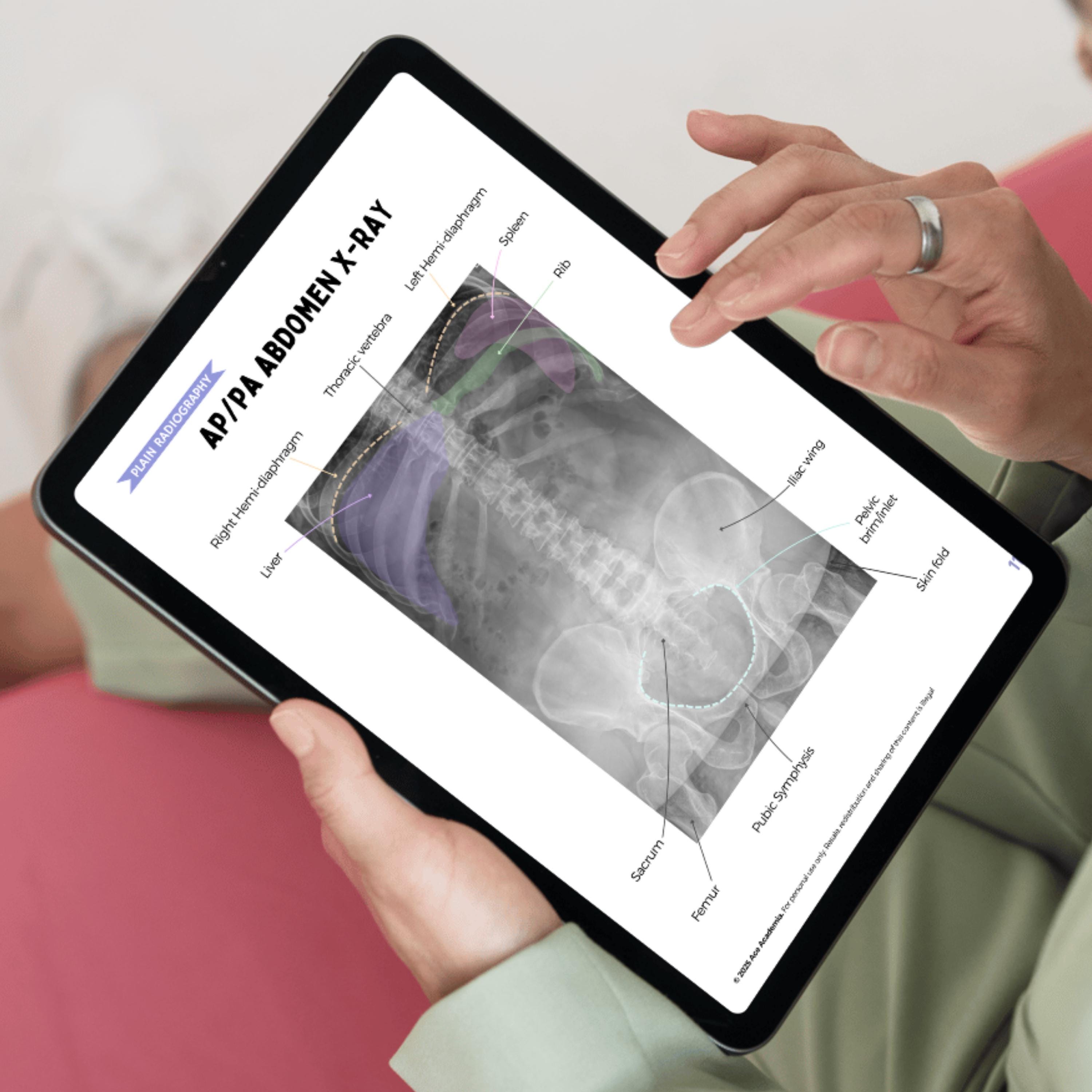 Abdomen X-ray Anatomy Guide: AP/PA View, Labeled Landmarks (PDF) - Etsy