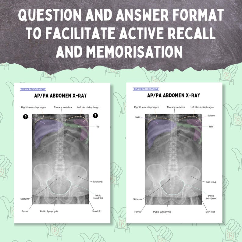 Axial Skeleton X-ray Anatomy Bundle: Radiography Study (PDF) - Etsy