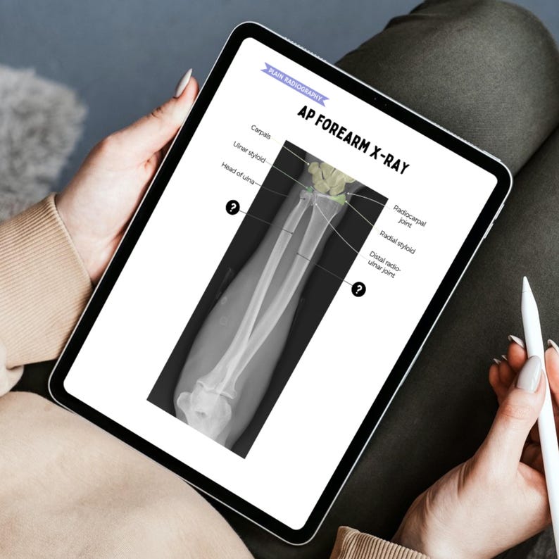 2026 Forearm X-ray Anatomy, AP and Lateral Study Bundle for Rad Techs ...