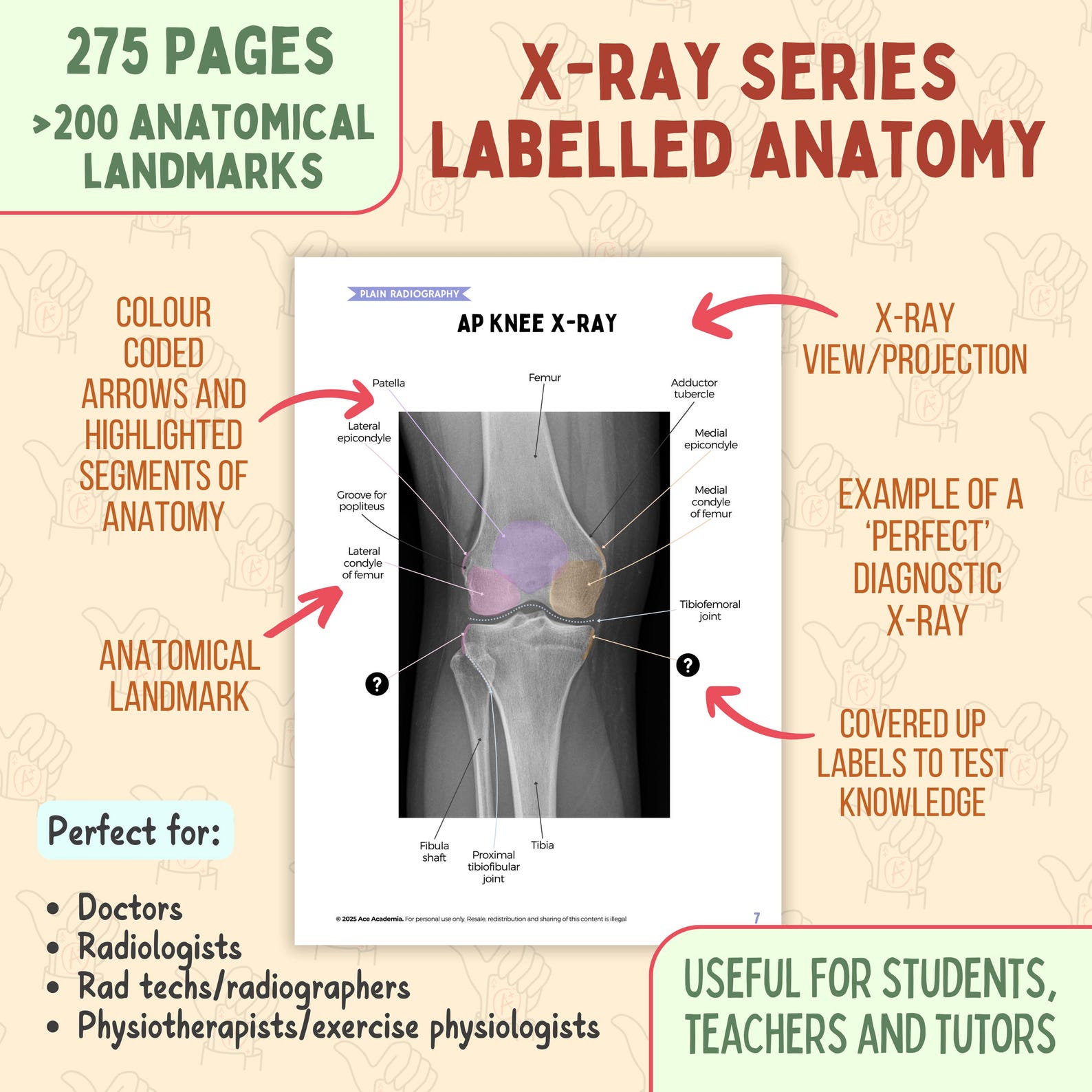 2025 Lower Limb X-ray Anatomy Bundle 275 Pages, Radiography Study ...