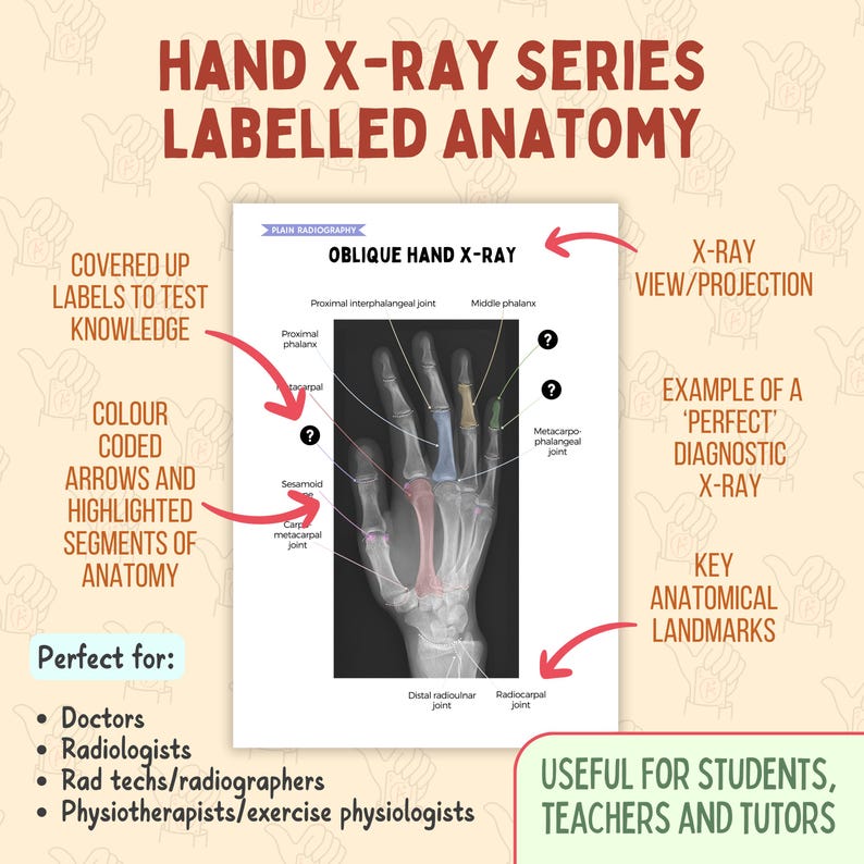 Hand X-ray Anatomy, AP Oblique & Lateral 2025 Radiography Study Bundle ...