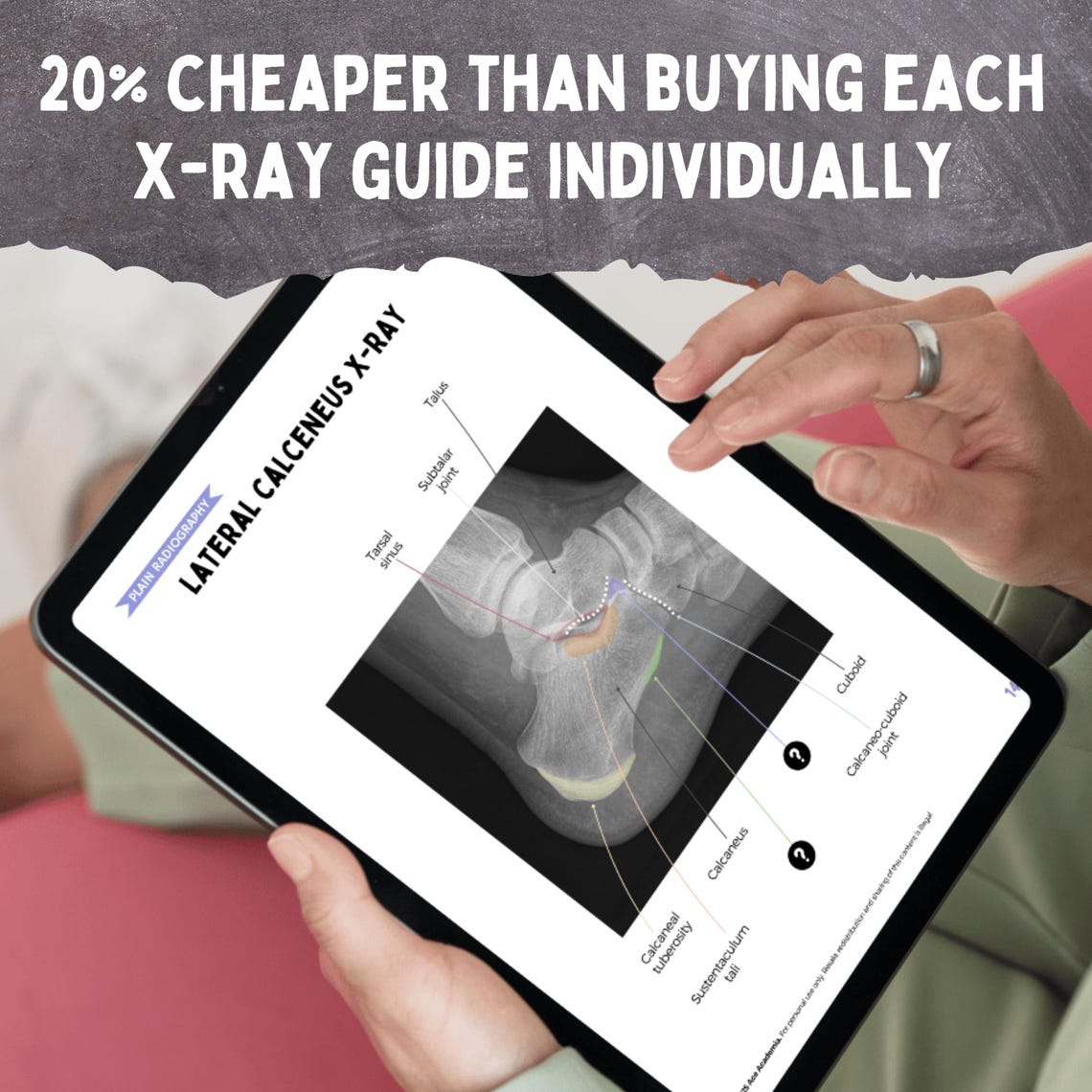2025 Lower Limb X-ray Anatomy Bundle 275 Pages, Radiography Study ...