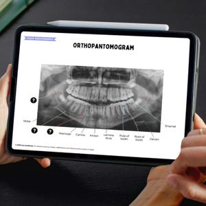 2026 OPG Dental X-ray Anatomy, Orthopantogram for Rad Techs ...