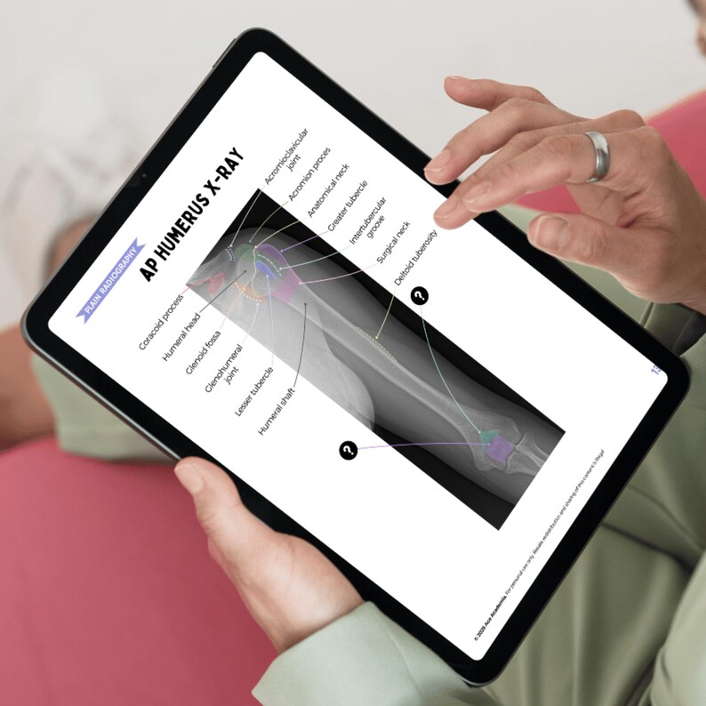 Humerus X-ray Anatomy Study Guide: AP & Lateral Views (PDF) - Etsy