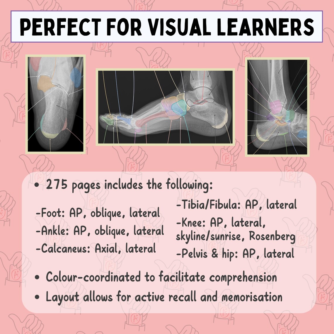 2025 Lower Limb X-ray Anatomy Bundle 275 Pages, Radiography Study ...