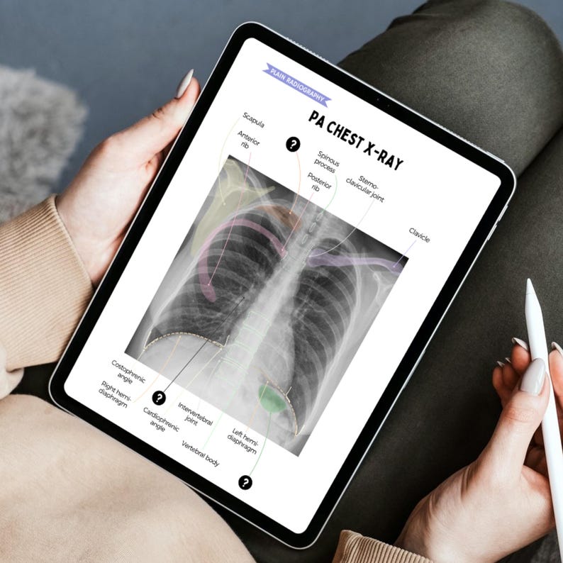 Chest X-ray Anatomy, PA and Lateral Views for Rad Techs, Radiographers ...