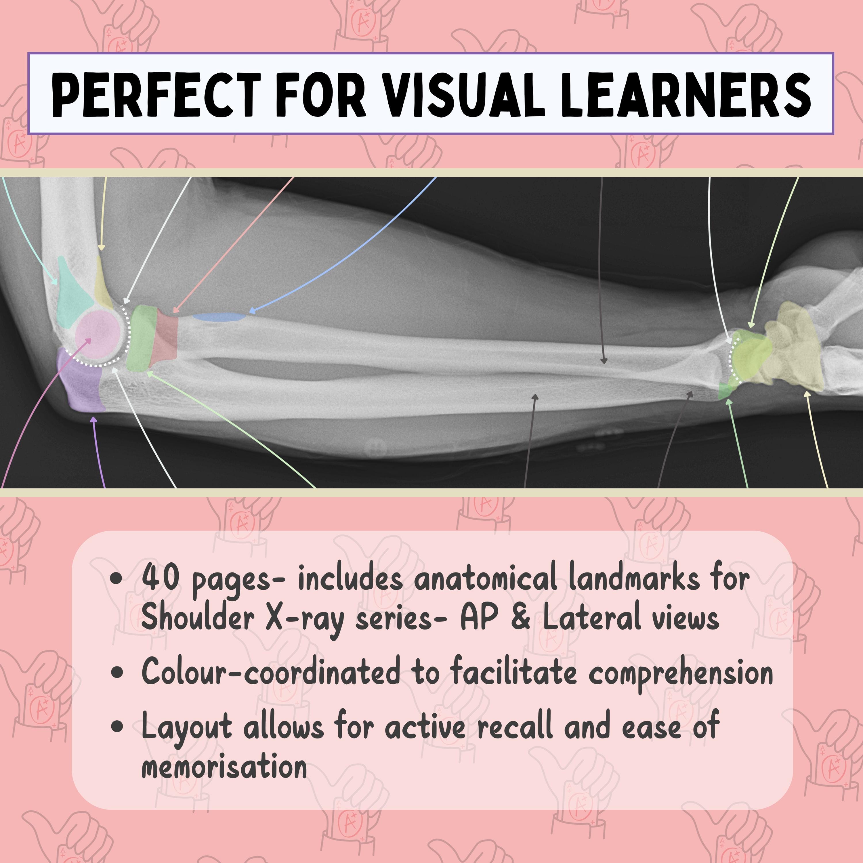 2025 Forearm X-ray Anatomy, AP and Lateral Study Bundle for Rad Techs ...