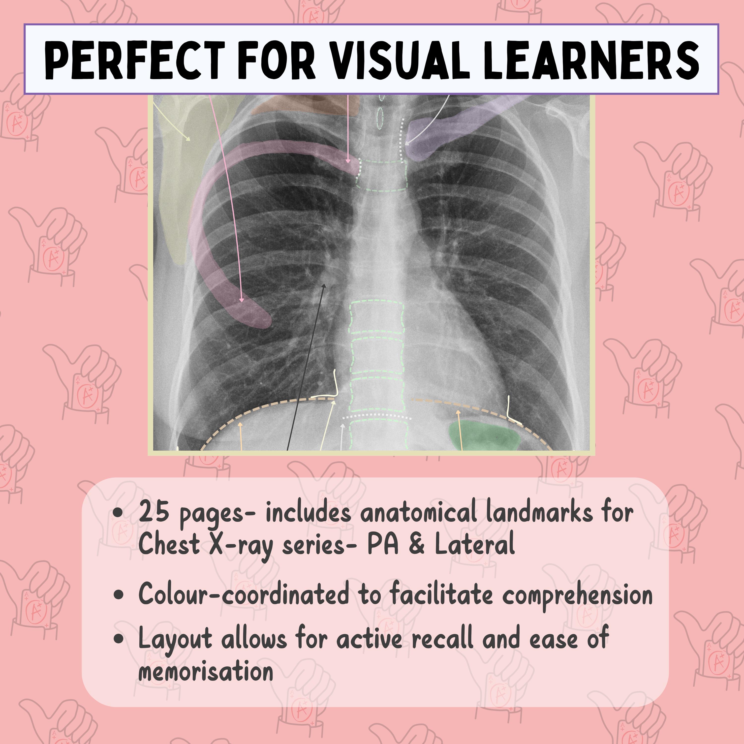 Chest X-ray Anatomy, PA and Lateral Views for Rad Techs, Radiographers ...