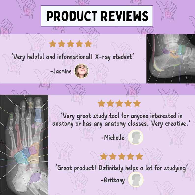 2025 Lower Limb X-ray Anatomy Bundle 275 Pages, Radiography Study ...