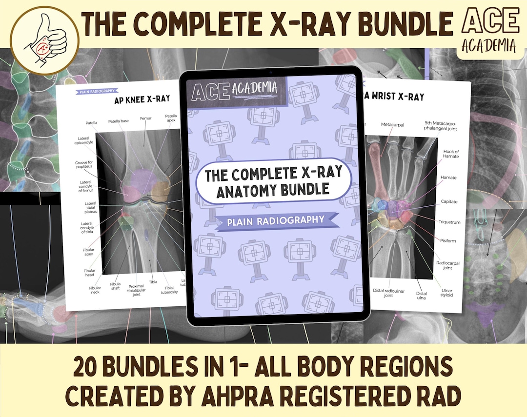 The Complete 2025 X-ray Anatomy Study Bundle, 900 Page Radiography Study Bundle for Rad Techs ...