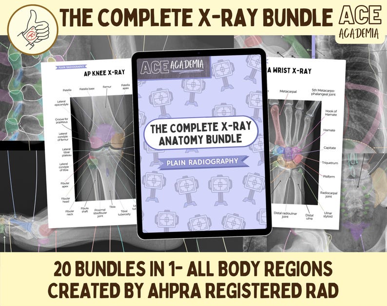 The Complete 2026 X-ray Anatomy Study Bundle, 900 Page Radiography ...