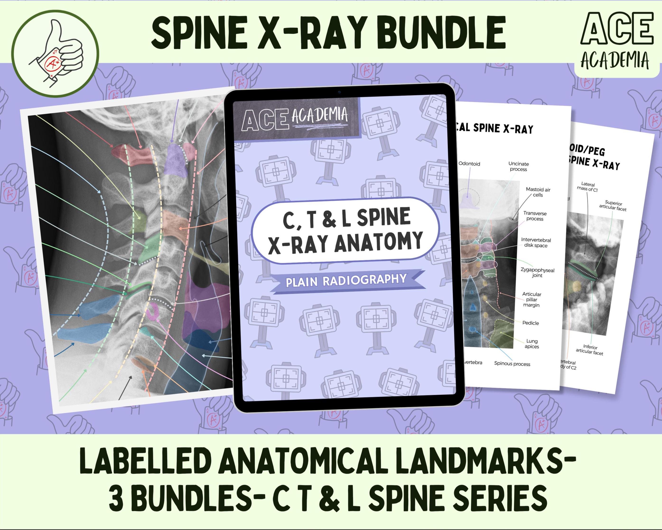 Cervical, Thoracic & Lumbar Spine Anatomy Bundle 2025, Radiography ...