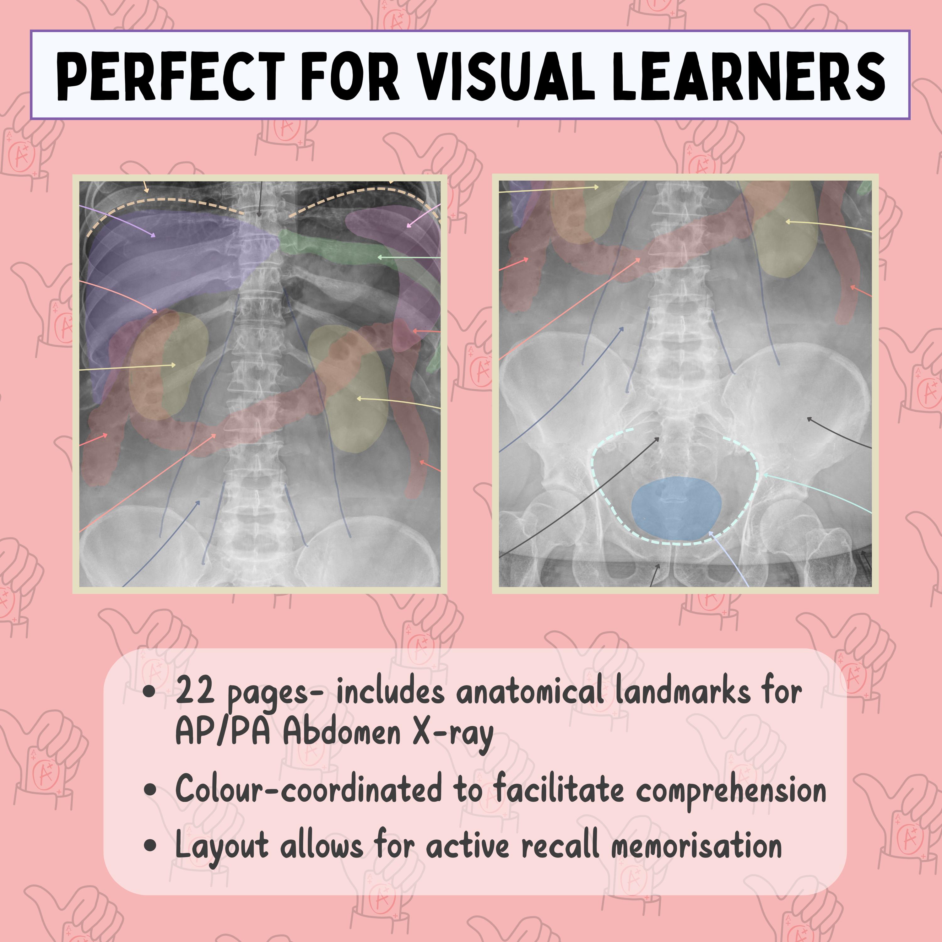 Abdomen X-ray Anatomy Guide: AP/PA View, Labeled Landmarks (PDF) - Etsy